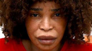 Acid attack: Mark van Dongen's ex-partner cleared of murder - BBC News