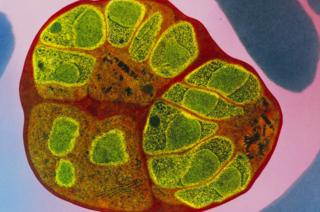 Malaria resistance 'unable to spread' - BBC News