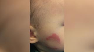 Wellingborough man admits biting toddler's face - BBC News