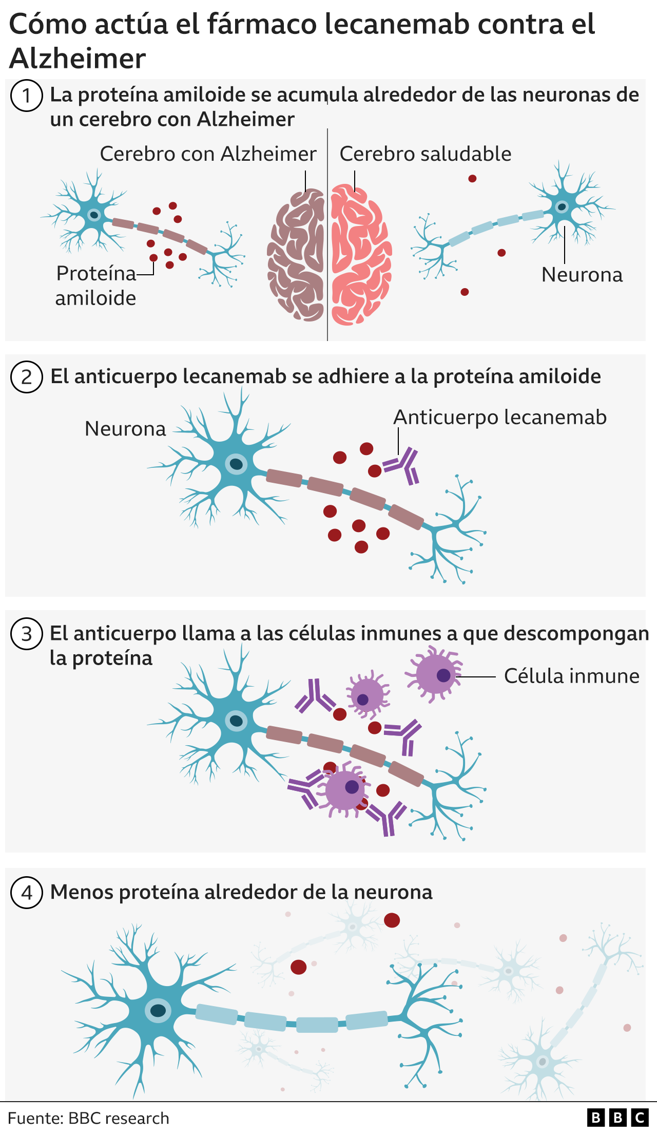 Alzhéimer: Estados Unidos aprueba lecanemab, el primer fármaco para ...