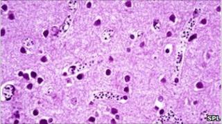 Cerebral malaria may have passed from gorillas to us - BBC News