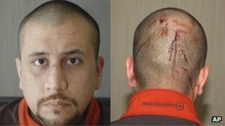 George Zimmerman was 'bleeding from the nose and head' - BBC News