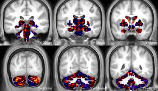 World's most detailed scans will reveal how brain works - BBC News