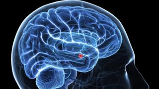 NHS England 'must monitor waits for autism diagnosis' - BBC News