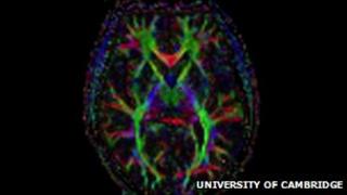 Brain scan study to understand workings of teenage mind - BBC News