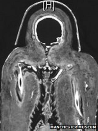 Scientists to scan Perth mummy 3,000 years after death - BBC News