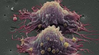 'Join cancer fight' call as death rates fall - BBC News