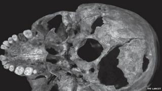King Richard III killed by blows to skull - BBC News