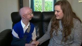 Alan Barnes fund: Donations halted for mugging victim - BBC News