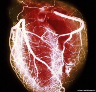 Doctors store 1,600 digital hearts for big data study - BBC News