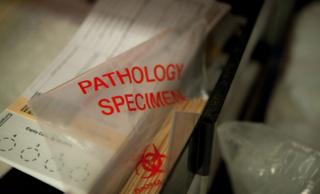 Seeing inside dead bodies - BBC News