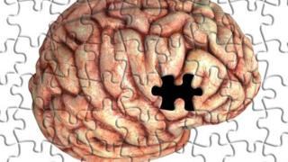 Peeking into the brain's filing system - BBC News
