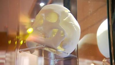 Replica Richard III skull features in Leicester Guildhall exhibition ...