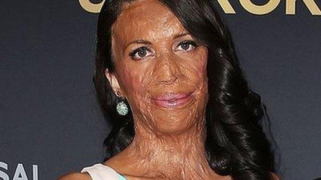 Turia Pitt: Australian burns survivor completes Hawaii triathlon - BBC News
