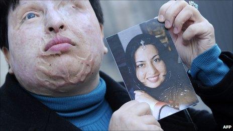 Iran acid attack: Ameneh Bahrami's quest for justice - BBC News