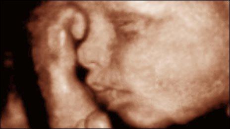 Foetus parties: Womb with a view? - BBC News