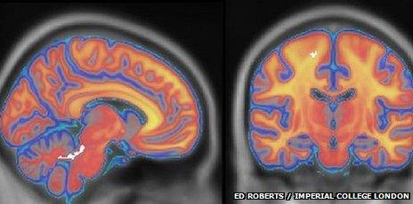 Karate punching power 'all in the brain' - BBC News