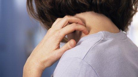 Itching and scratching a 'vicious cycle', say researchers - BBC News