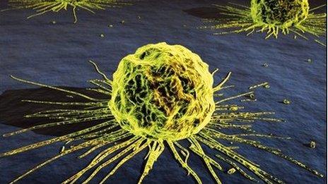 Turning cancer back into healthy tissue - BBC News