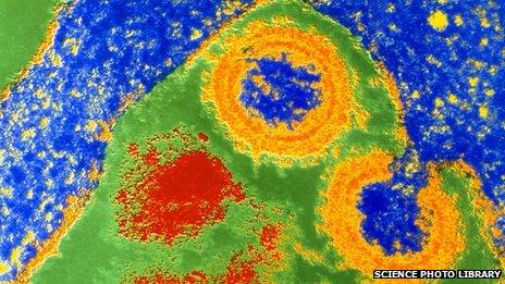 Vaccine 'clears HIV-like virus' in monkeys - BBC News