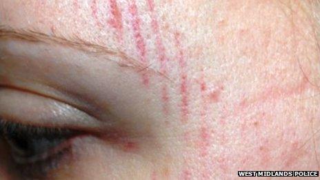 Birmingham thieves leave 'footprint' on victim's face - BBC News