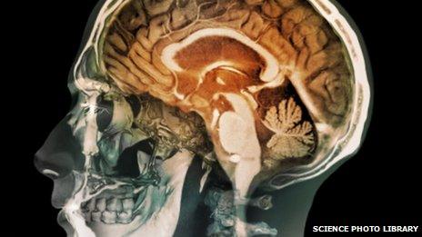 Alcohol-related brain damage report highlights concerns - BBC News