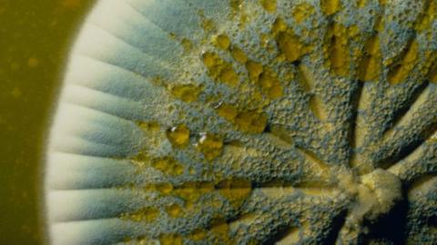 ¿Son las barbas la solución contra las invencibles bacterias? - BBC ...