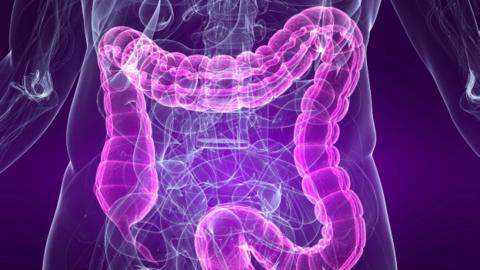 Qué hacer para aliviar los incómodos síntomas del colon irritable - BBC ...