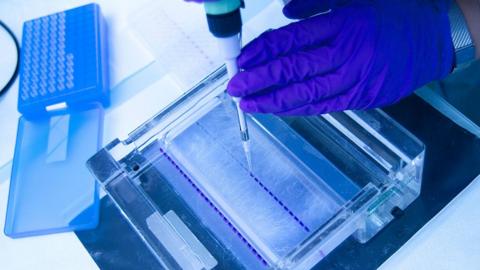 Faster diagnosis from 'transformational' gene project - BBC News