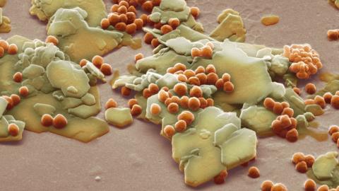 Plastic microbeads to be banned by 2017, UK government pledges - BBC News