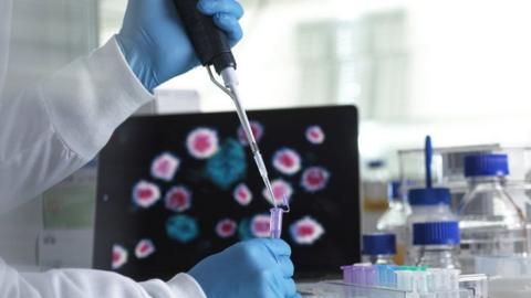Covid-19: Irish scientists discover link to life threatening blood ...