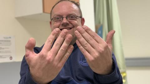 Man has hand reattached after 'horrific' machine accident - BBC News