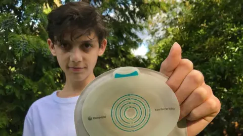Teenager's posts show stoma bag 'not end of the world'