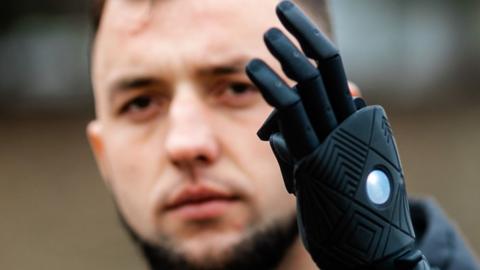 Where Ukraine’s army of amputees go to repair their lives - BBC News