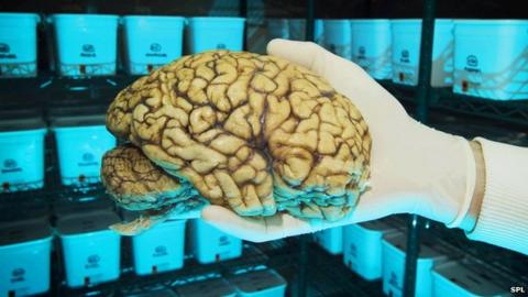 Peeking into the brain's filing system - BBC News