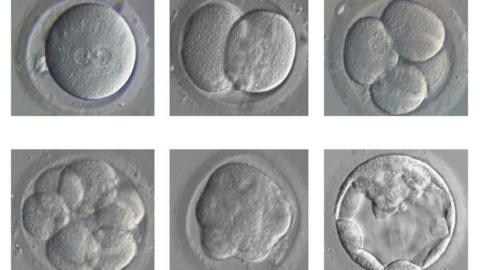 Embryo study shows 'life's first steps' - BBC News