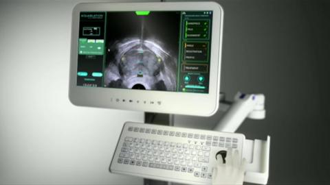 Prostate cancer: Hormone drug gave me years of good health, patient ...
