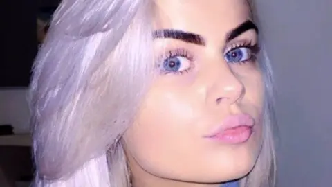 'Rebuilding my life after my boyfriend nearly killed me'