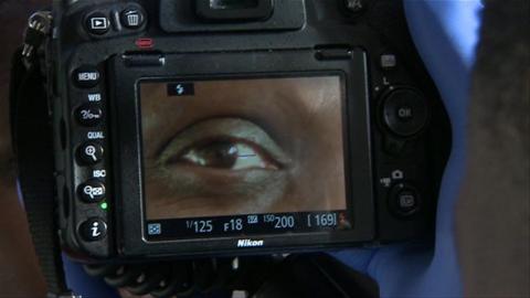 NHS project tackles diversity of skin tones in medical photos - BBC ...