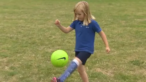 Ffion Rudman, six, gets blade after sepsis leg loss