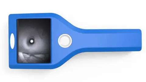 Cambridge doctor urges parents to join baby cataract study