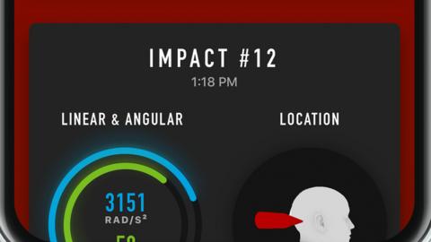 Smart Mouthguards: What are they, and how can they help rugby players ...