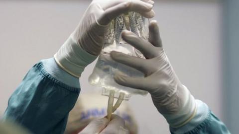 'Thousands' of known bugs found in pacemaker code - BBC News