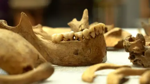 Battle of Waterloo skeletons uncovered in Belgium