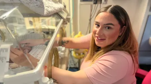 Premature baby who weighed 410g has first birthday