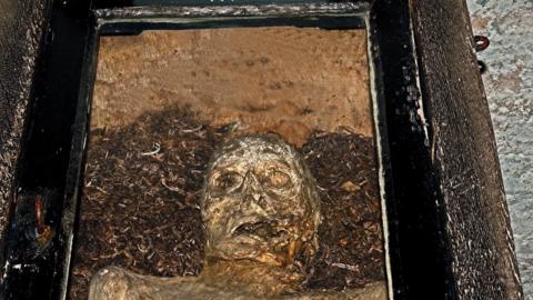 Por qué sigue siendo difícil determinar cuándo estamos muertos - BBC ...