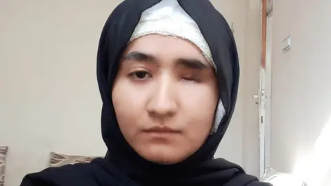 Afghan female student injured in suicide attack passes university entrance exams