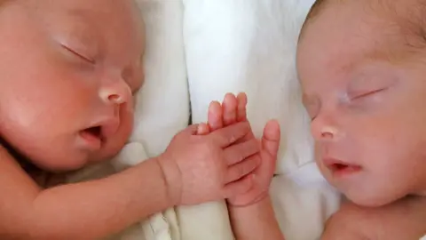 Semi-identical twins 'identified for only the second time'