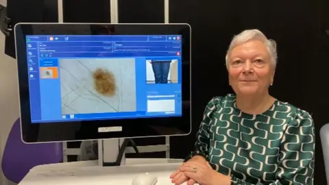 Man's dying wish for skin mole-map machine comes true