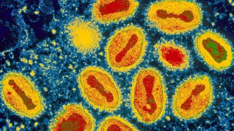 How smallpox claimed its final victim - BBC News